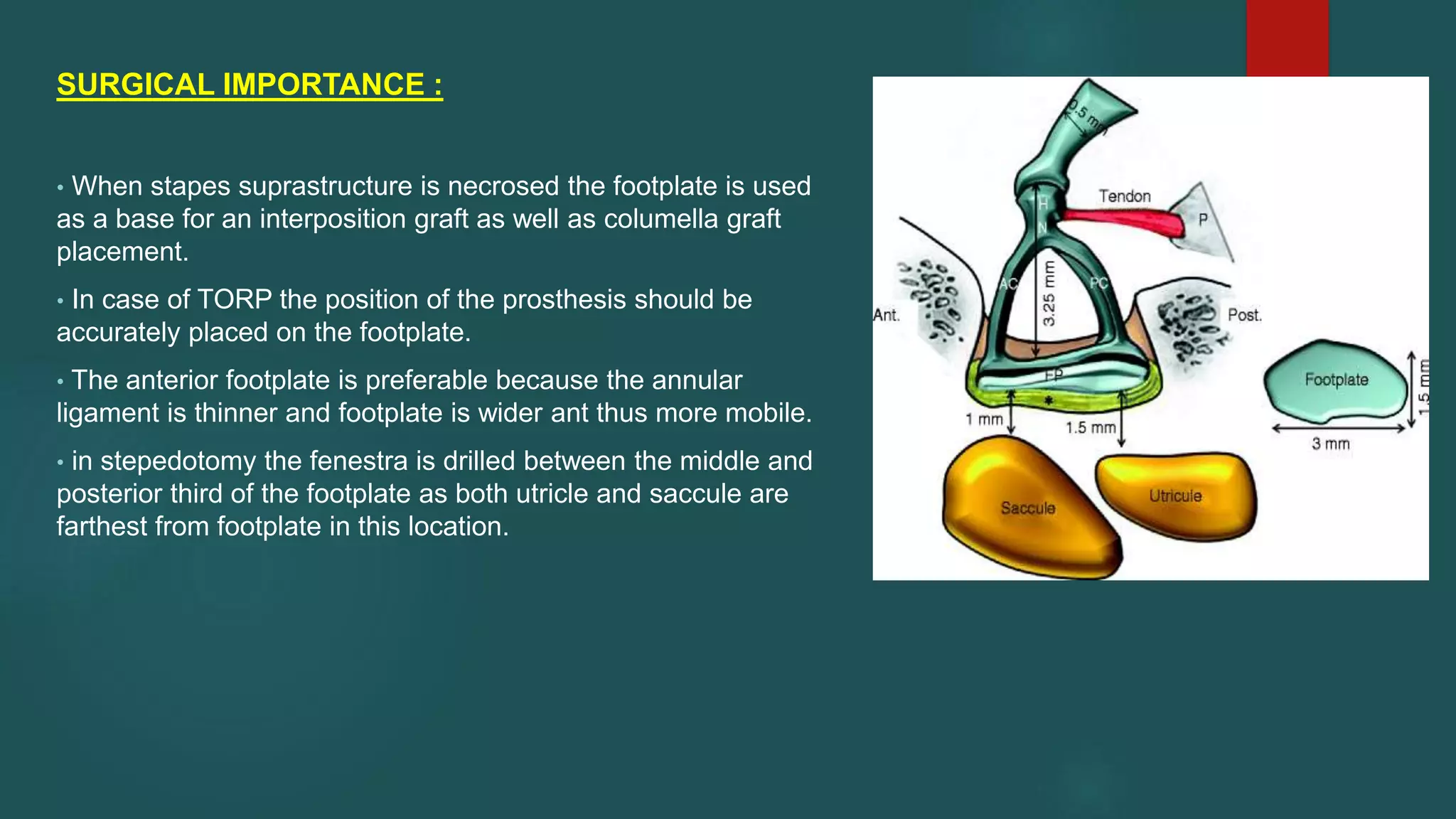 Ossiculoplasty | PPTX