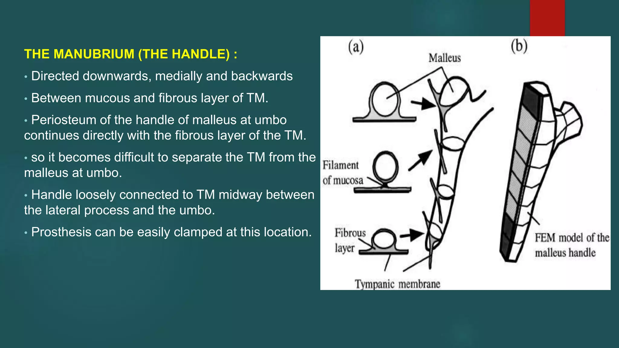 Ossiculoplasty | PPTX