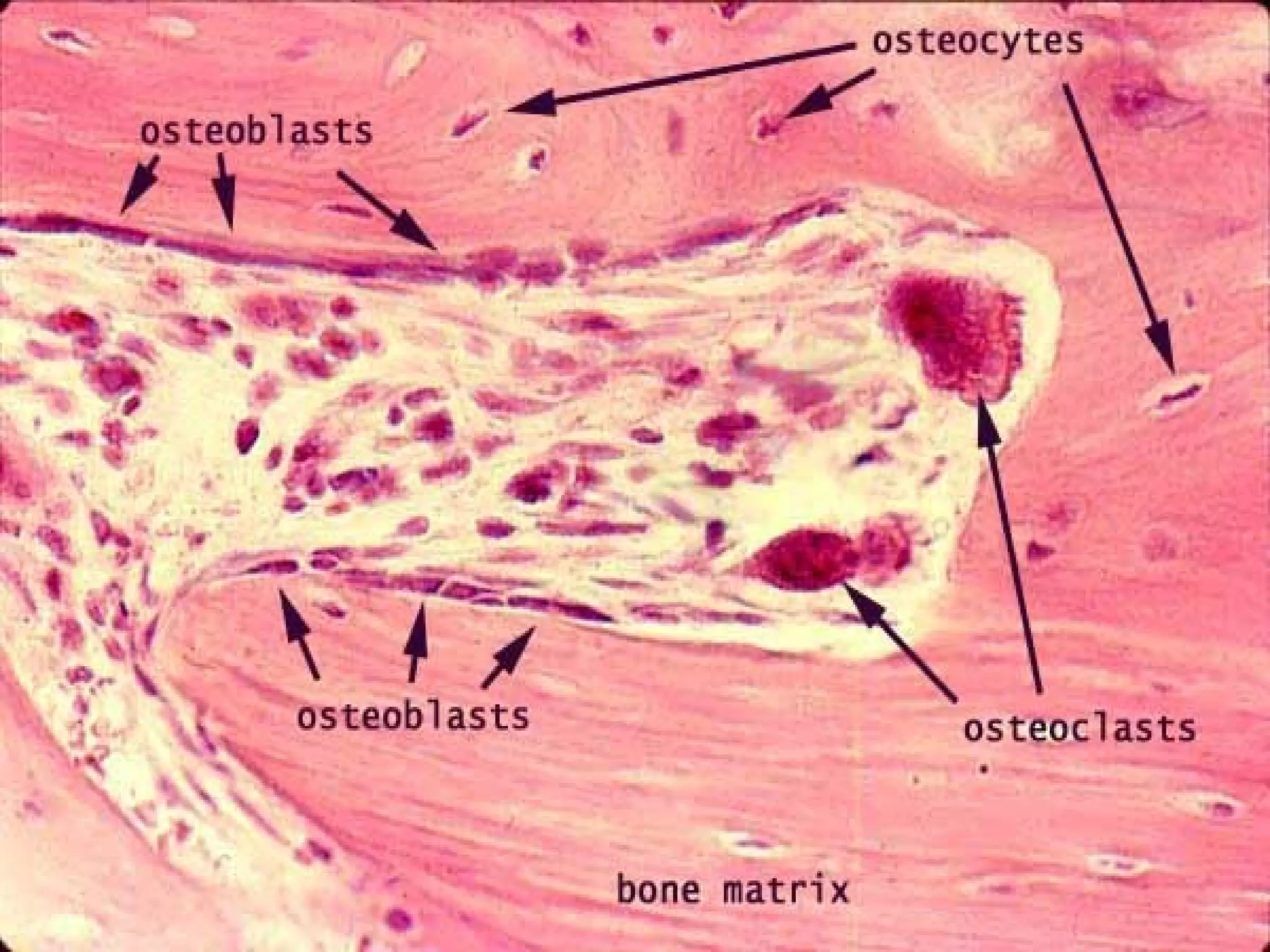 Ossification | PPT