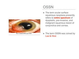 OSSN | PPT