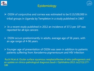 OSSN.ppt