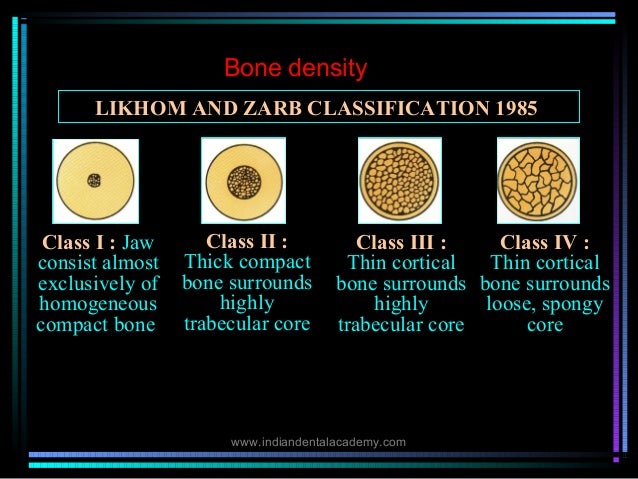 Ossntgrtn / orthodontic straight wire technique