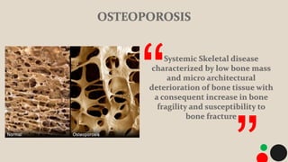 Oss Pro Flash 1.pptx