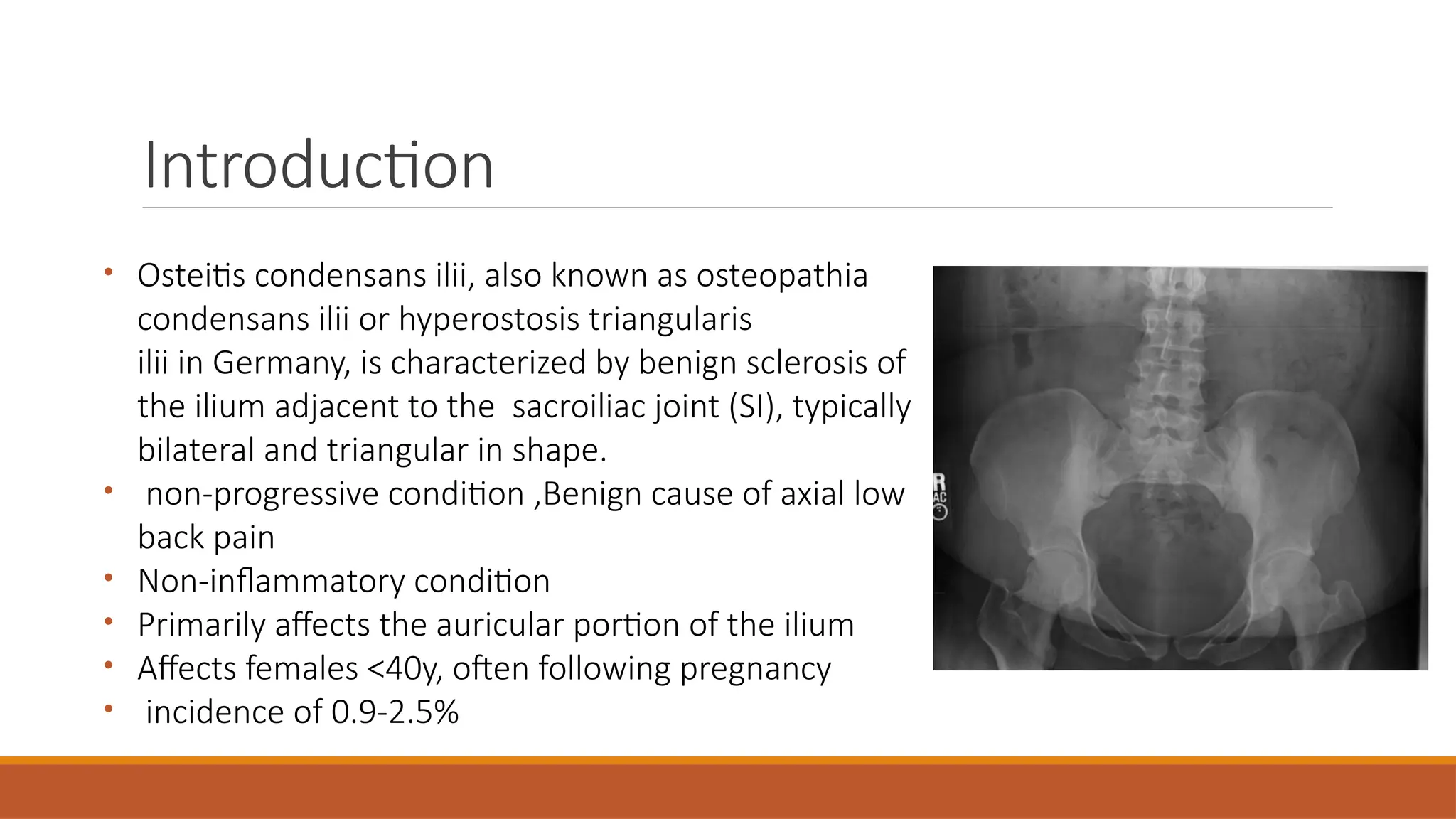 Osteitis condensans ilii or osteopathia condensans ilii.pptx