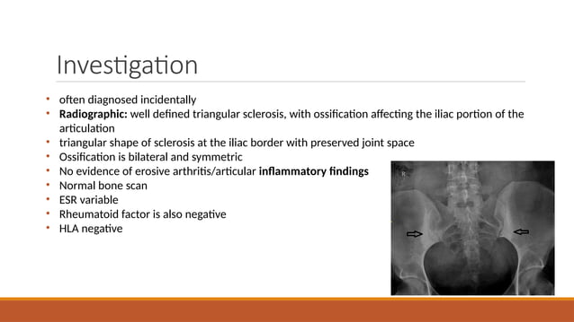 Osteitis condensans ilii or osteopathia condensans ilii.pptx