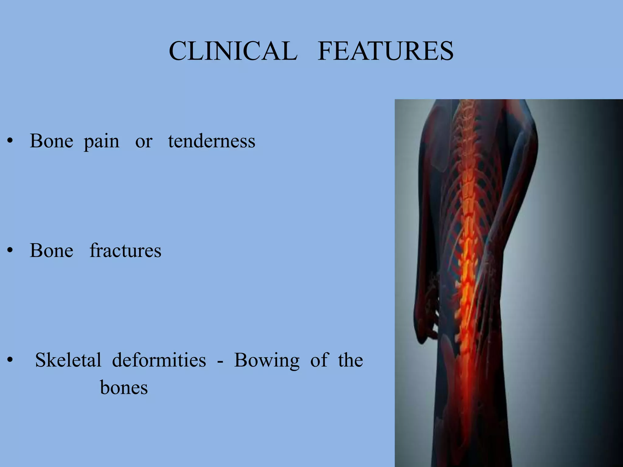 Osteitis fibrosa cystica | PPTX