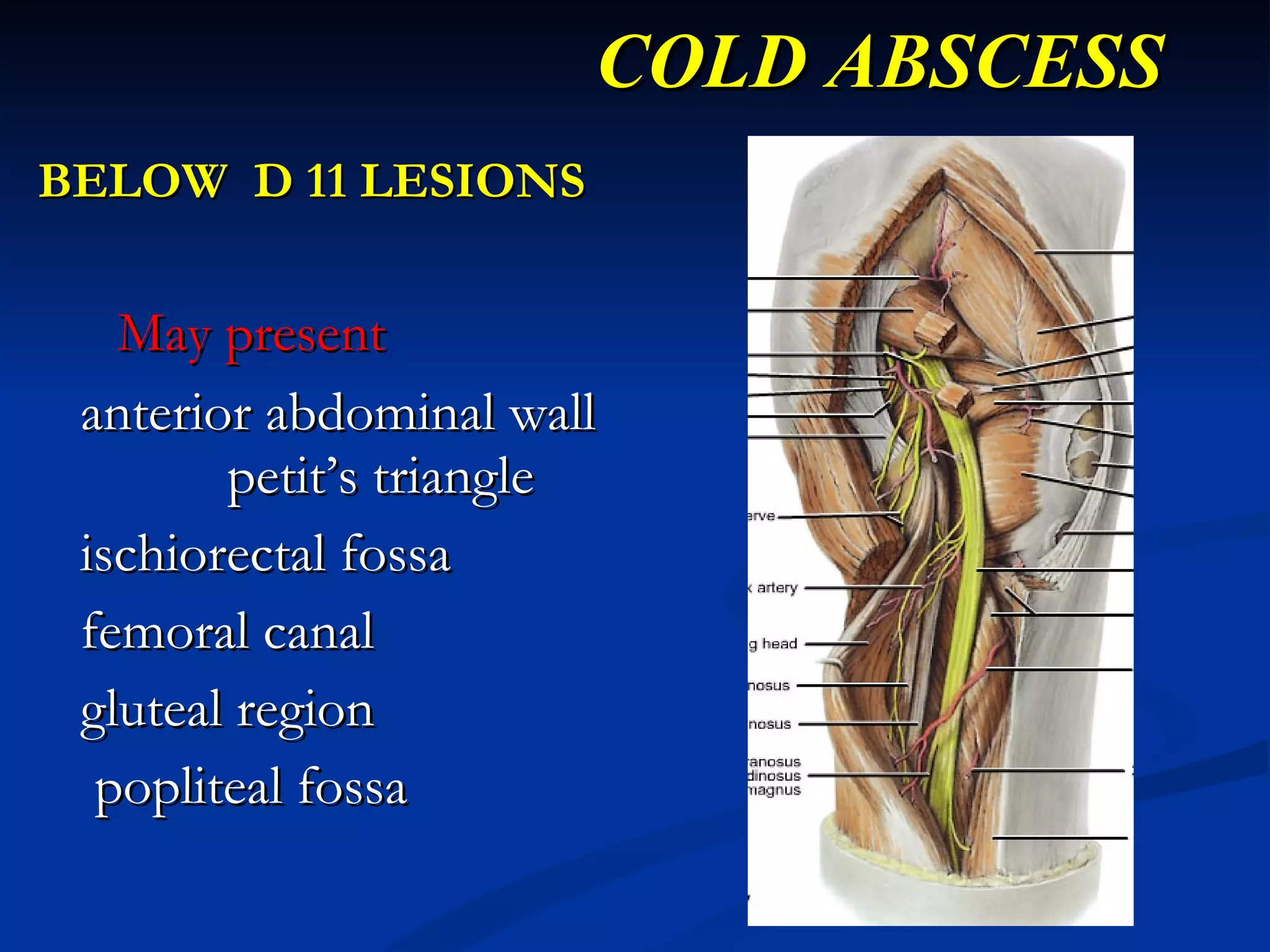 Osteo articular tuberculosis -1 | PPT