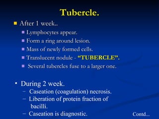 Osteo articular tuberculosis -1 | PPT
