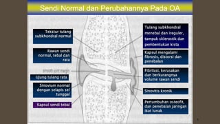 Osteoarthritis dan Artritis Gout | PPTX