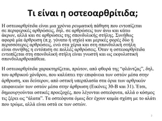 Οστεοαρθρίτιδα | PPT