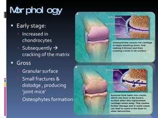 Osteoarthritis | PPT