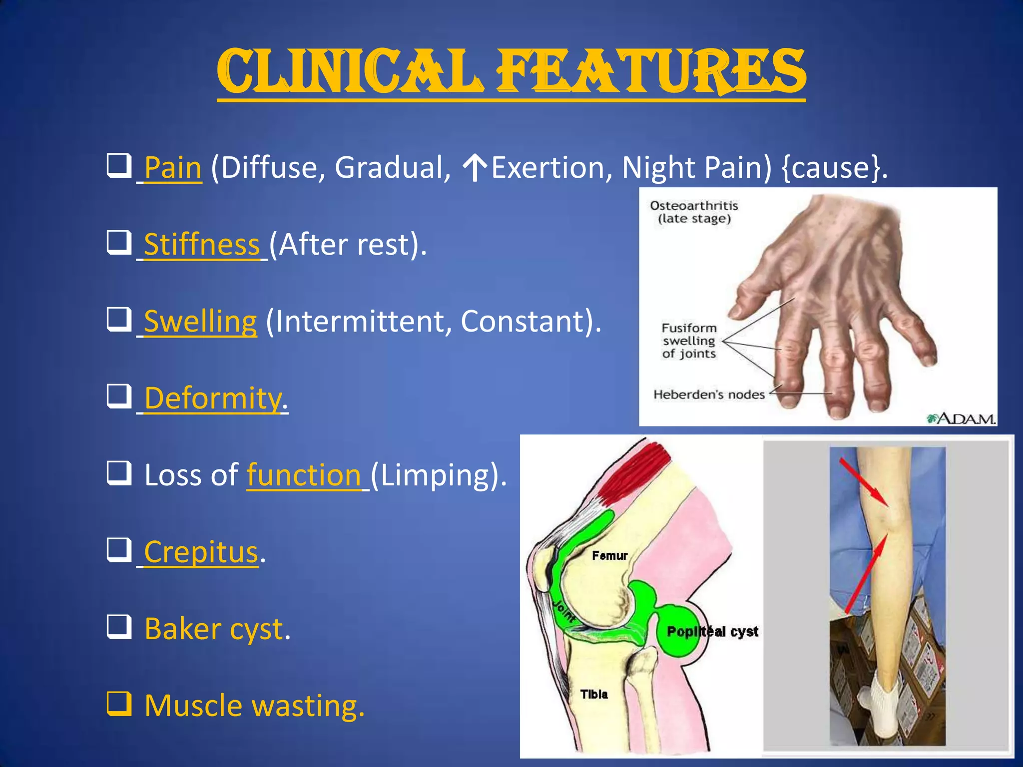 orthopedics.Osteoarthritis.(dr.ariwan) | PPTX | Death, Injury, or ...