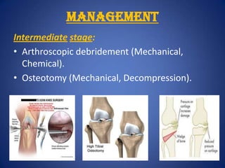 orthopedics.Osteoarthritis.(dr.ariwan) | PPTX