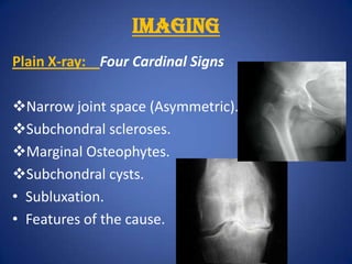 orthopedics.Osteoarthritis.(dr.ariwan) | PPTX