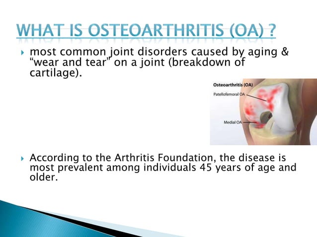 Osteoarthritis | PPTX