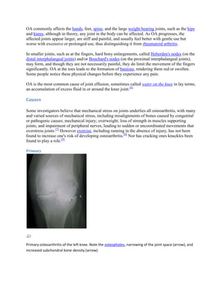 Osteoarthritis | DOCX