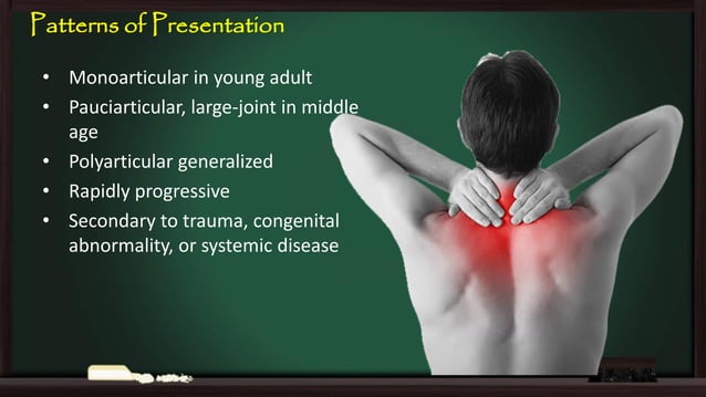 Osteoarthritis | PPT