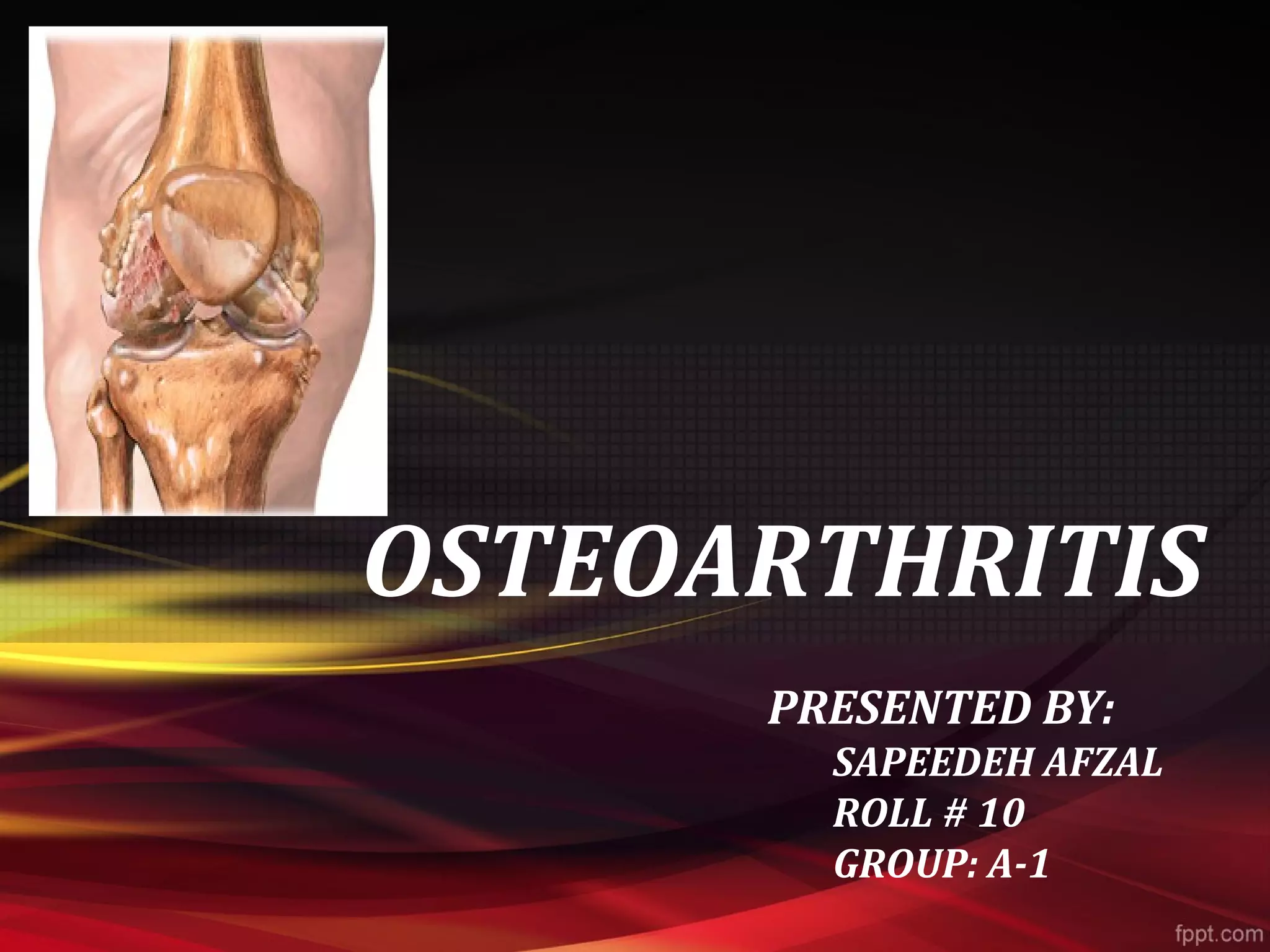 Osteoarthritis | PPT