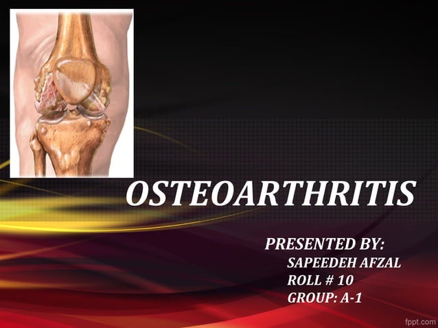 Osteoarthritis | PPT | Bone and Joint Conditions | Diseases and Conditions