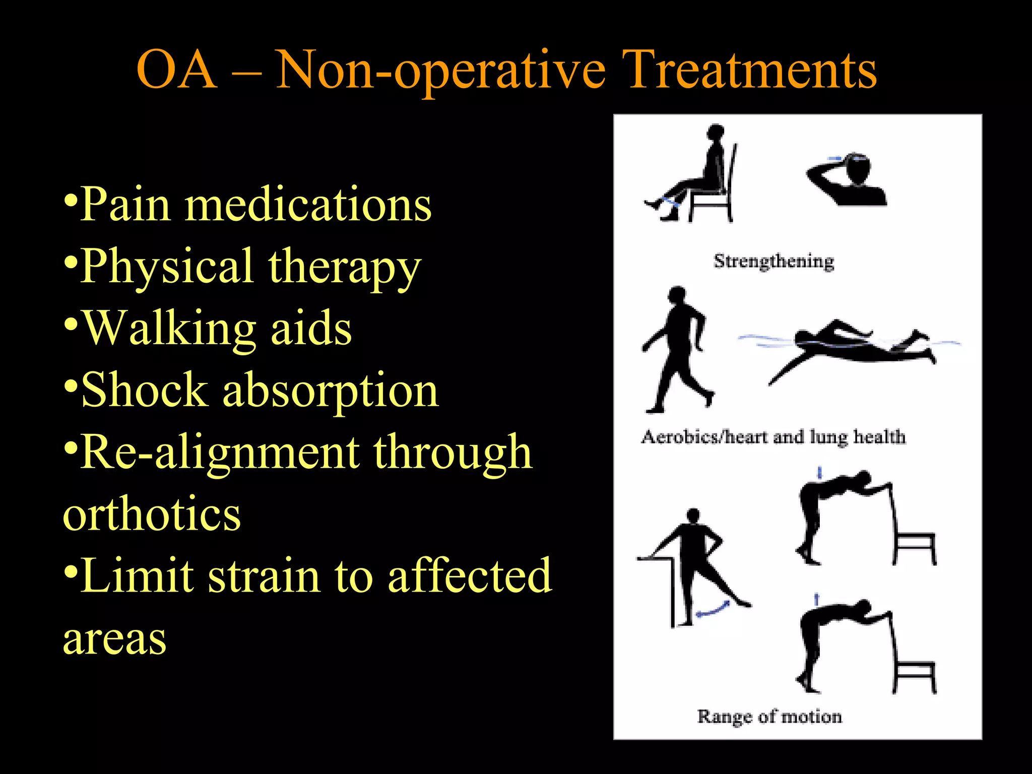 Osteoarthritis | PPT
