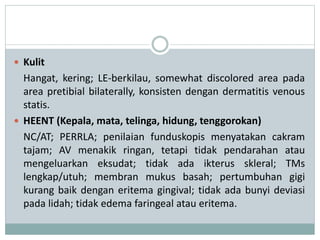Osteoarthritis | PPTX