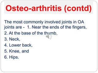 Osteoarthritis | PPT