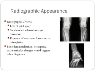 Osteoarthritis | PPT
