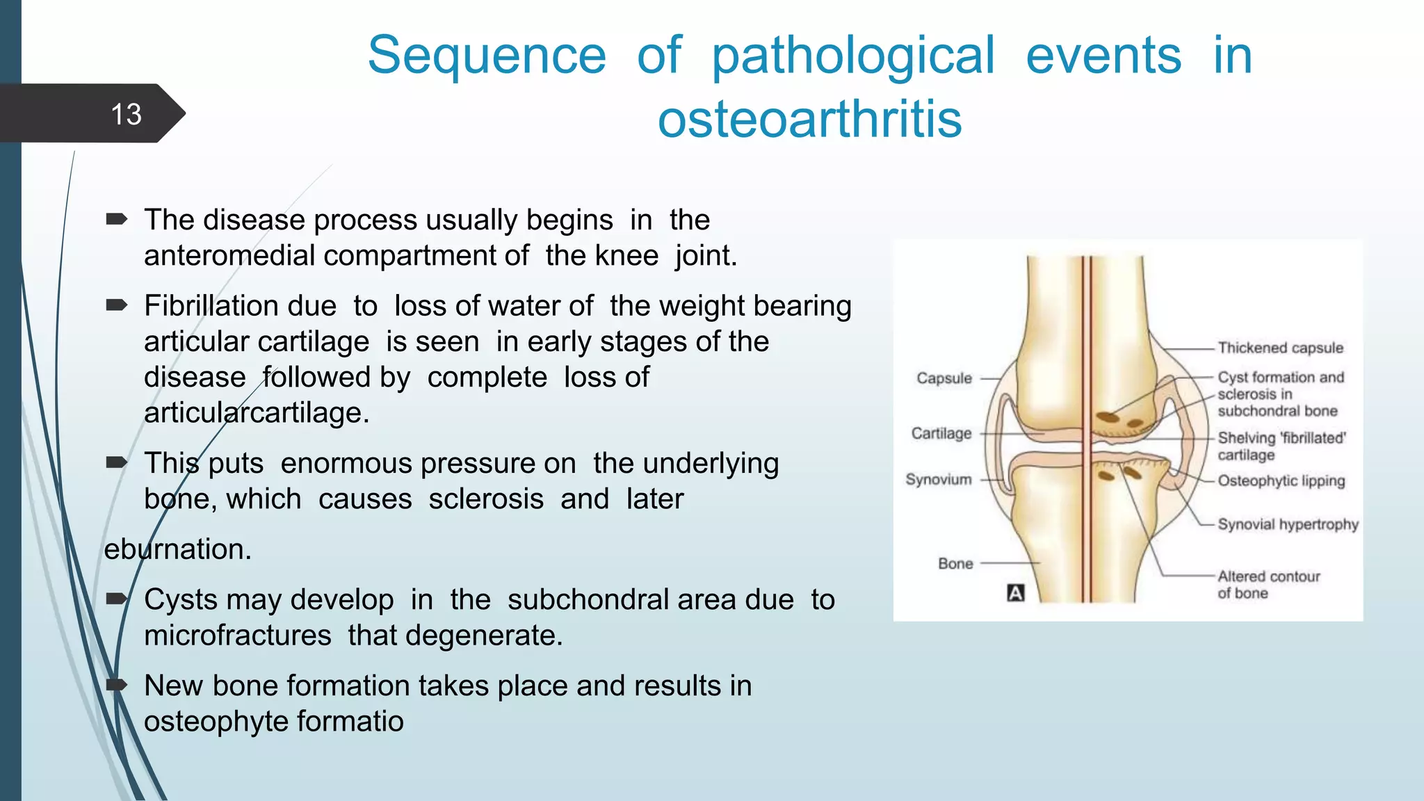 Knee joint Osteoarthritis | PPTX