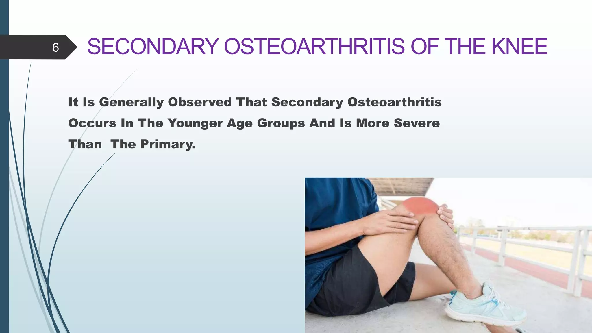 Knee joint Osteoarthritis | PPTX
