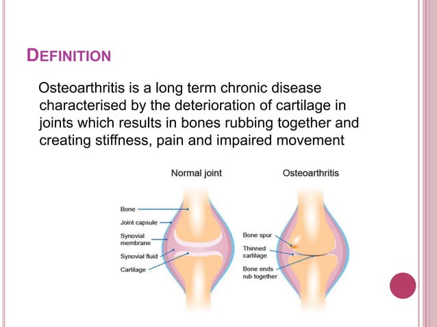 Osteoarthritis | PPTX