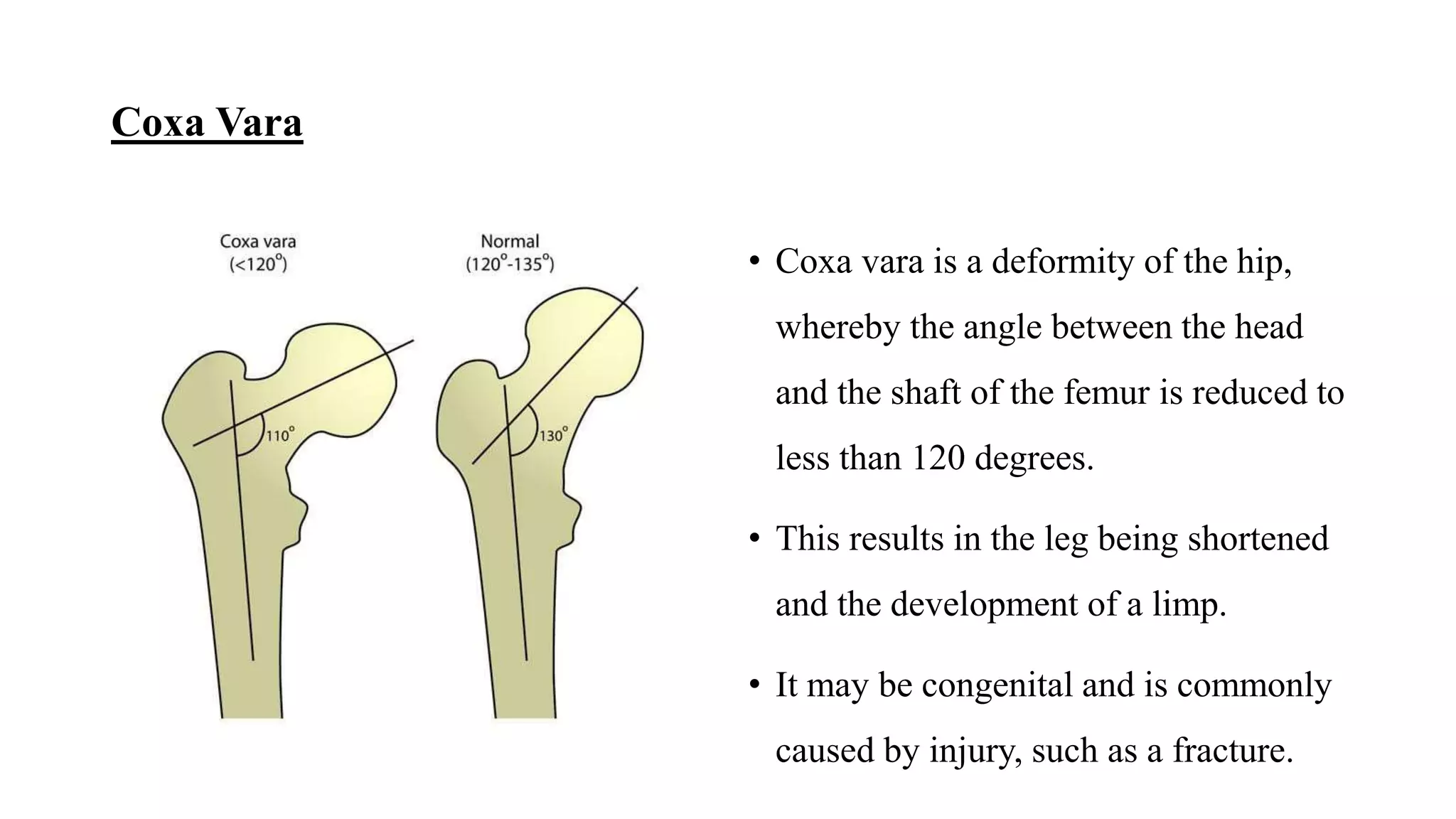 Osteoarthritis by Dr. K. A Rana -2.pptx