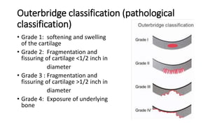 Osteoarthritis | PPTX | Physical Therapy | Wellness