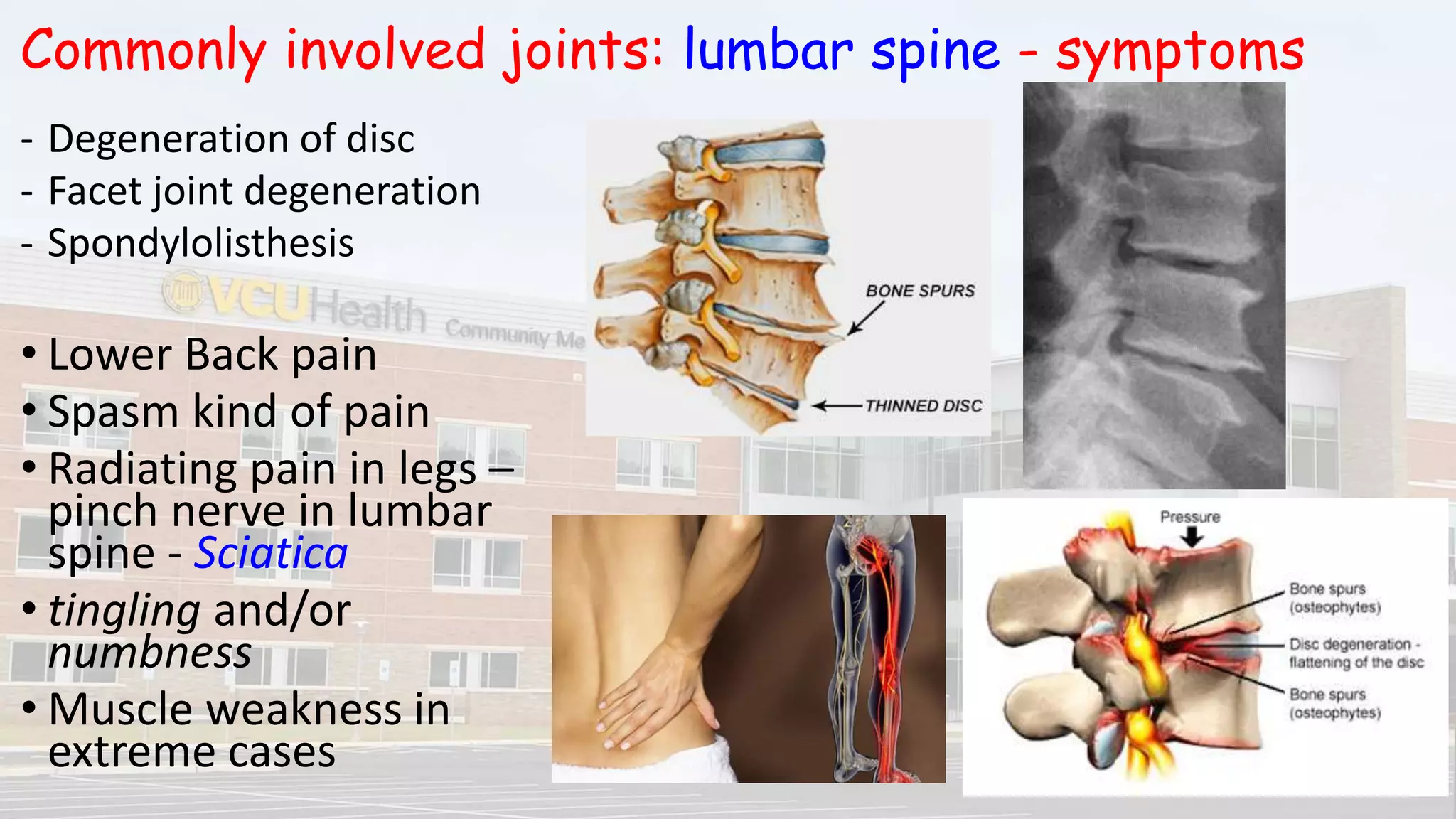Osteoarthritis of joints and related treatment | PPTX