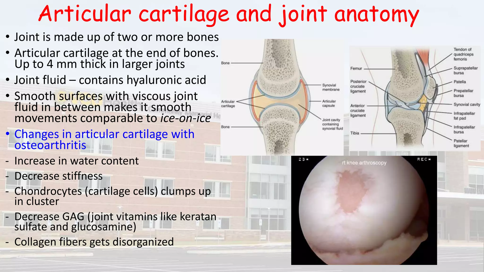 Osteoarthritis of joints and related treatment | PPTX