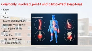 Osteoarthritis of joints and related treatment | PPTX