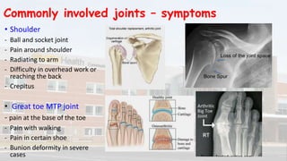 Osteoarthritis of joints and related treatment | PPTX
