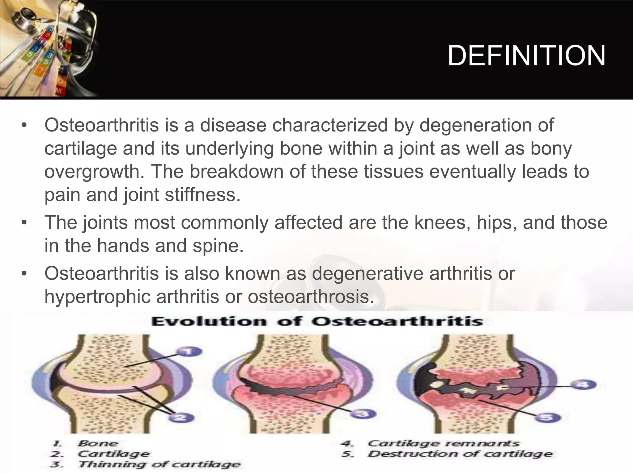Osteoarthritis | PPT