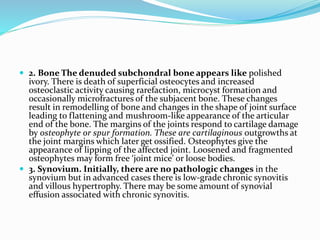 osteoarthritis.pptx