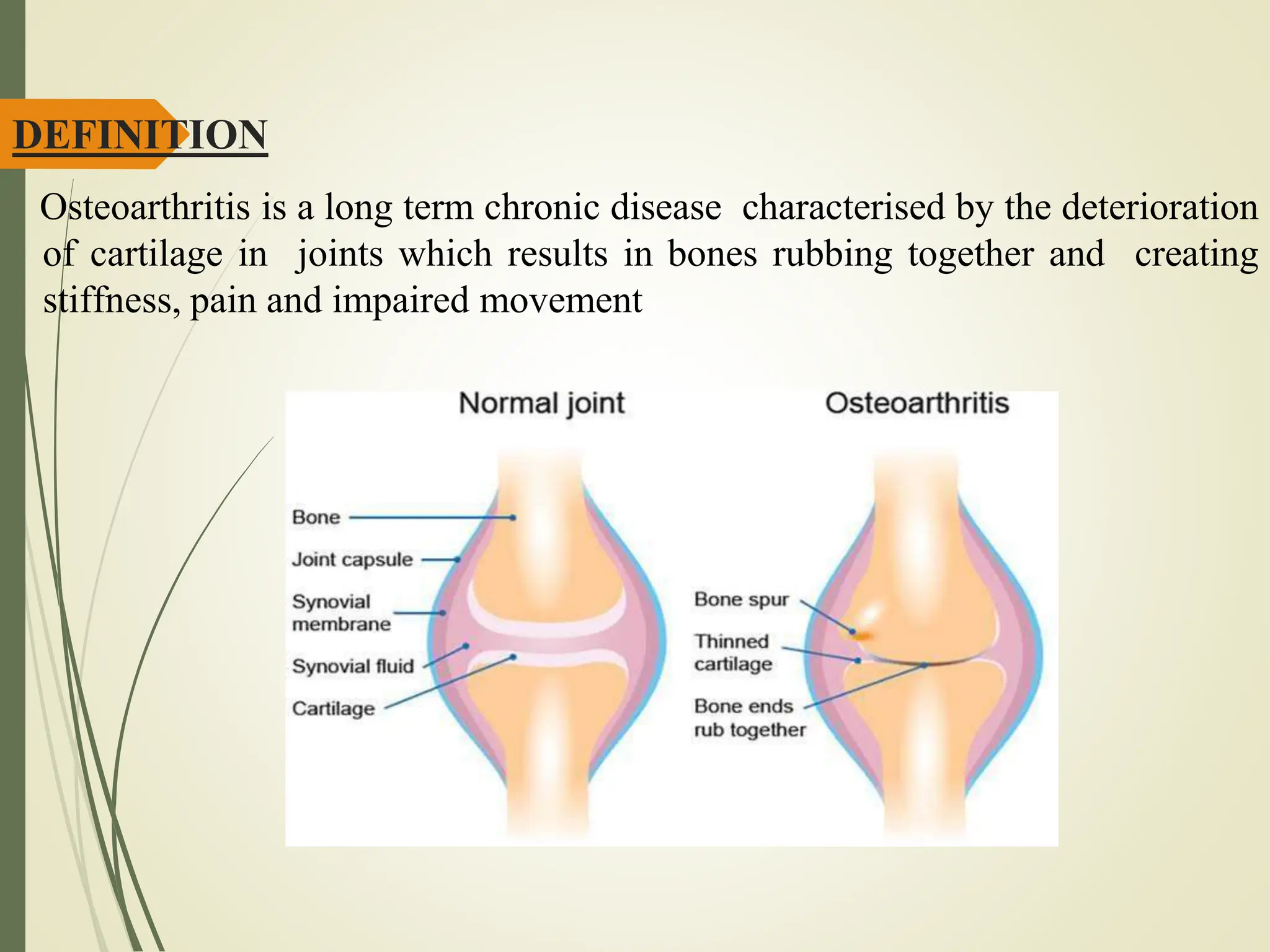Osteoarthritis.pptx