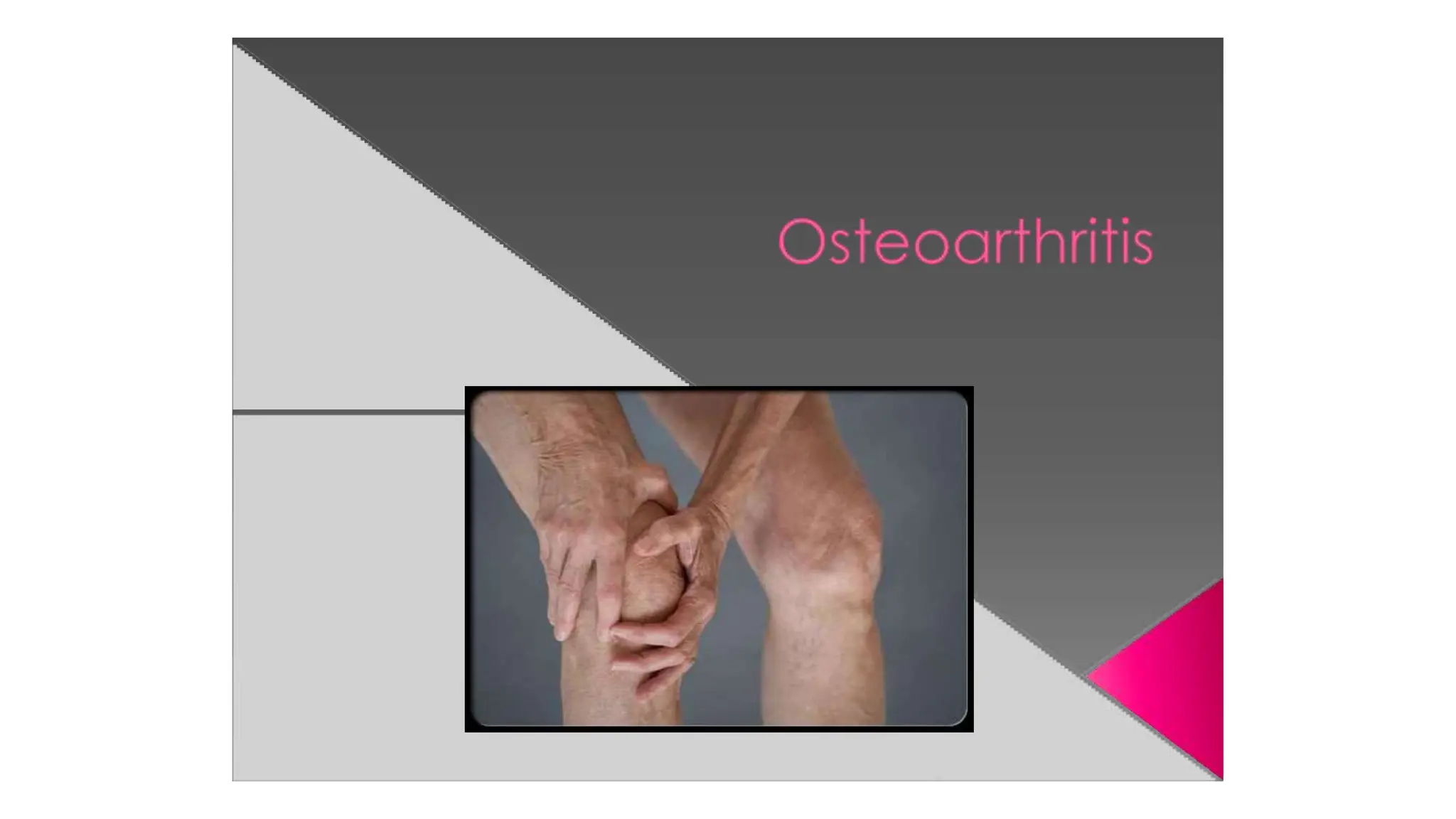 OSTEOARTHRITIS.PPT and its cause and treatment | PPTX