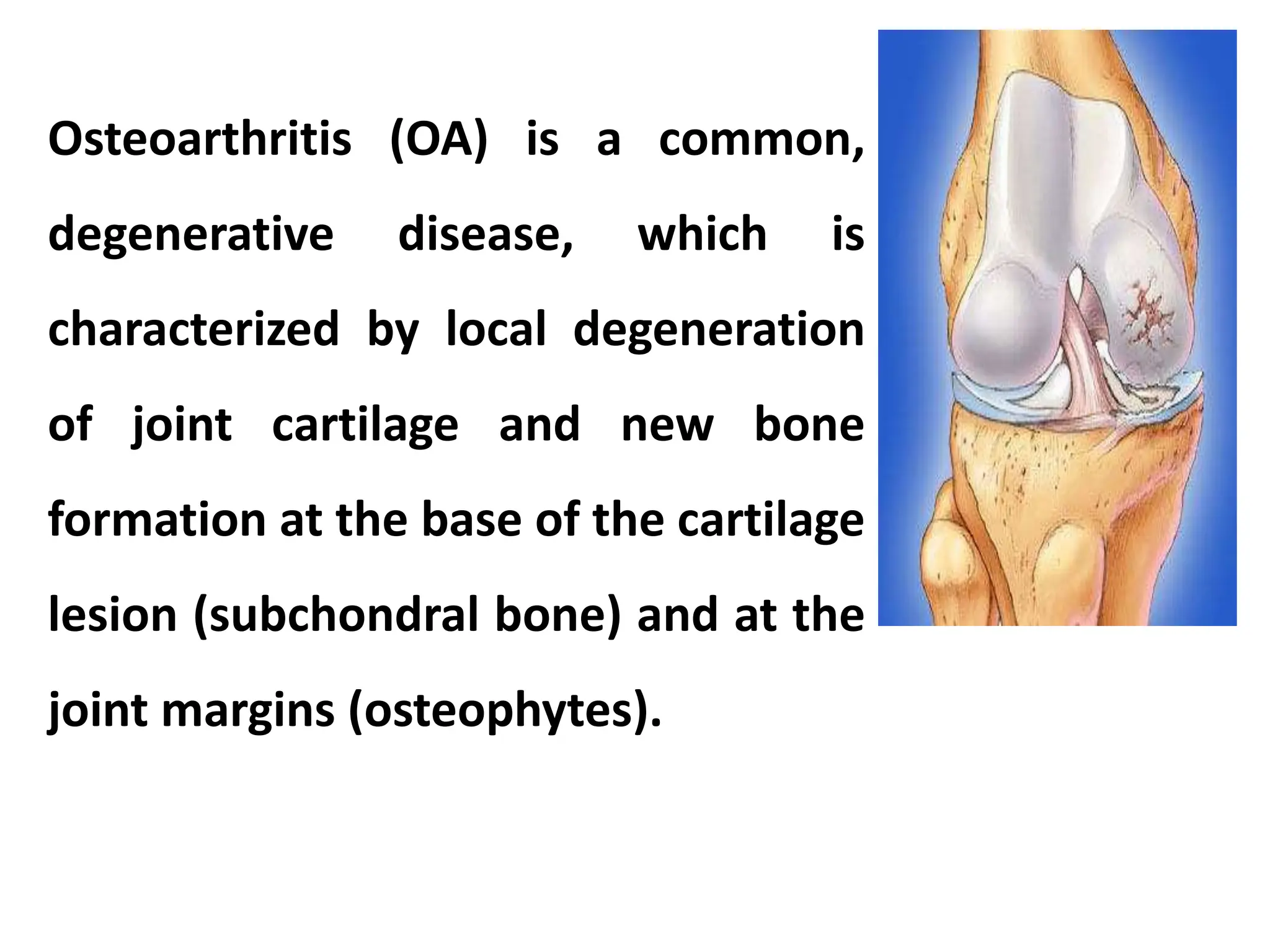 Osteoarthritis with mechanism, pathology and treatment | PPT