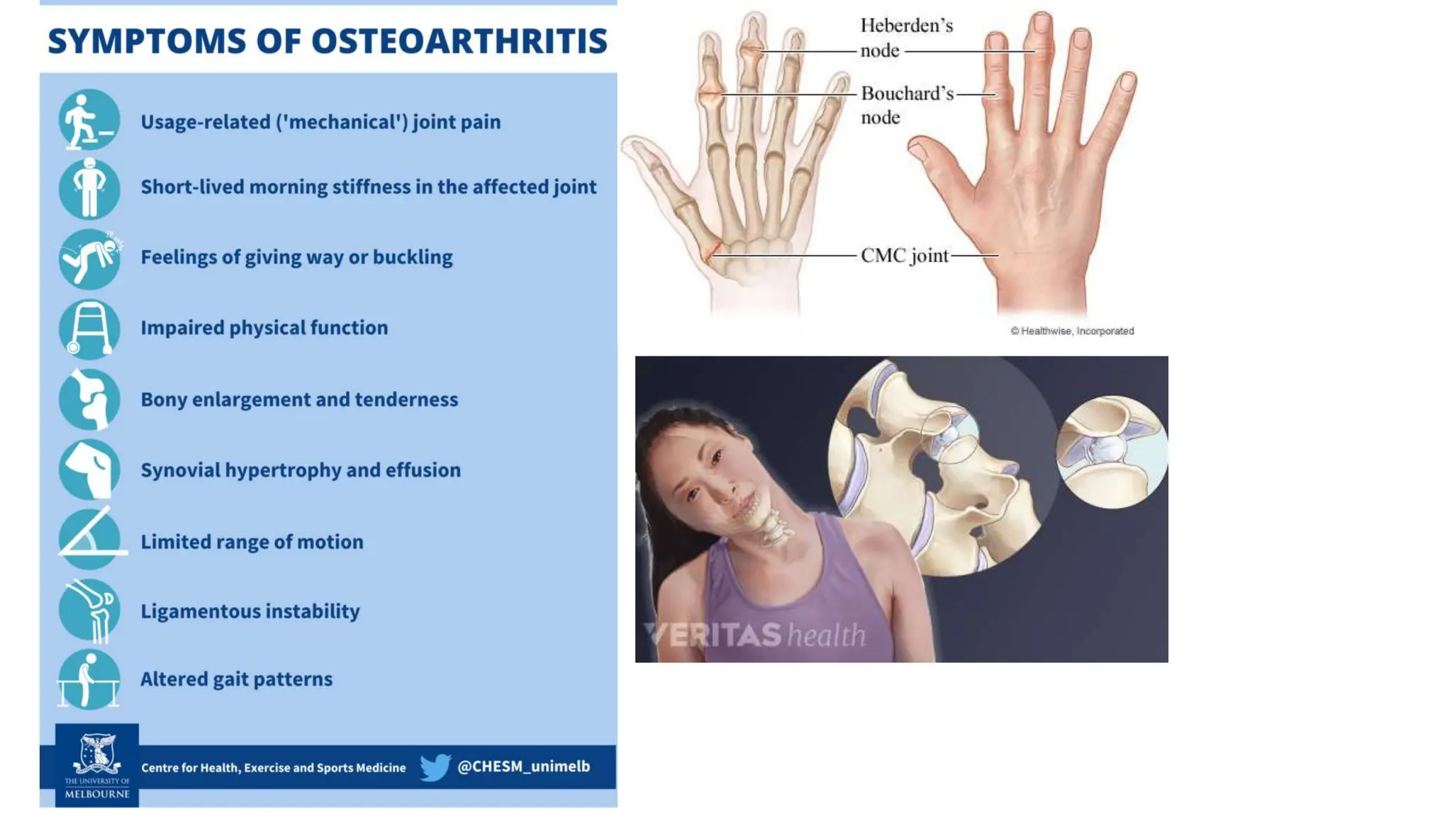 Musculoskeletal disorders: Osteoarthritis,.pptx