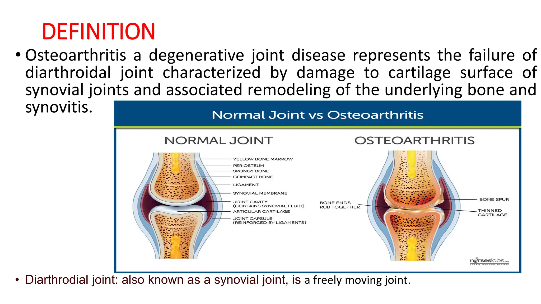 Musculoskeletal Disorders Osteoarthritis Pptx