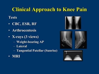 Nyeri Lutut (Osteoarthritis Knee).ppt
