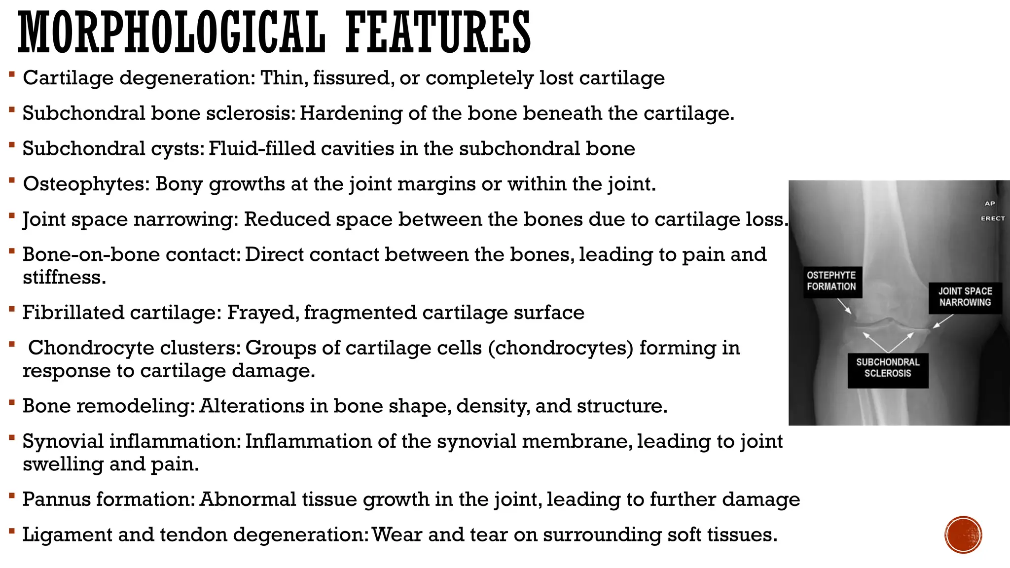 Osteoarthritis (Musculoskeletal deformities).pptx
