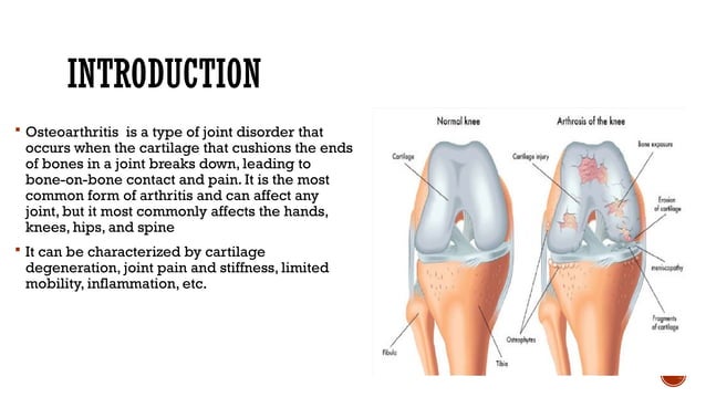 Osteoarthritis (Musculoskeletal deformities).pptx