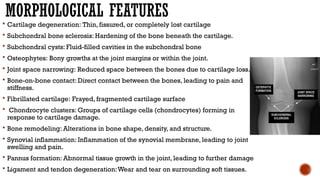 Osteoarthritis (Musculoskeletal deformities).pptx