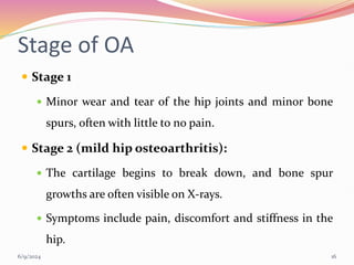 osteoarthritis of the hip and medical management .pdf