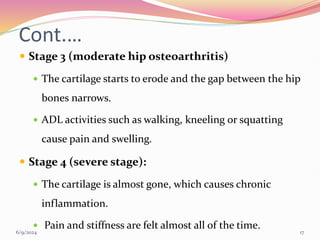 osteoarthritis of the hip and medical management .pdf