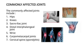 OSTEOARTHRITIS and management plan .pptx